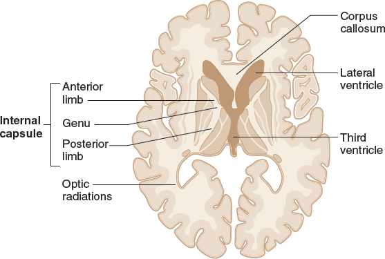mymedschool.orgInternal capsule