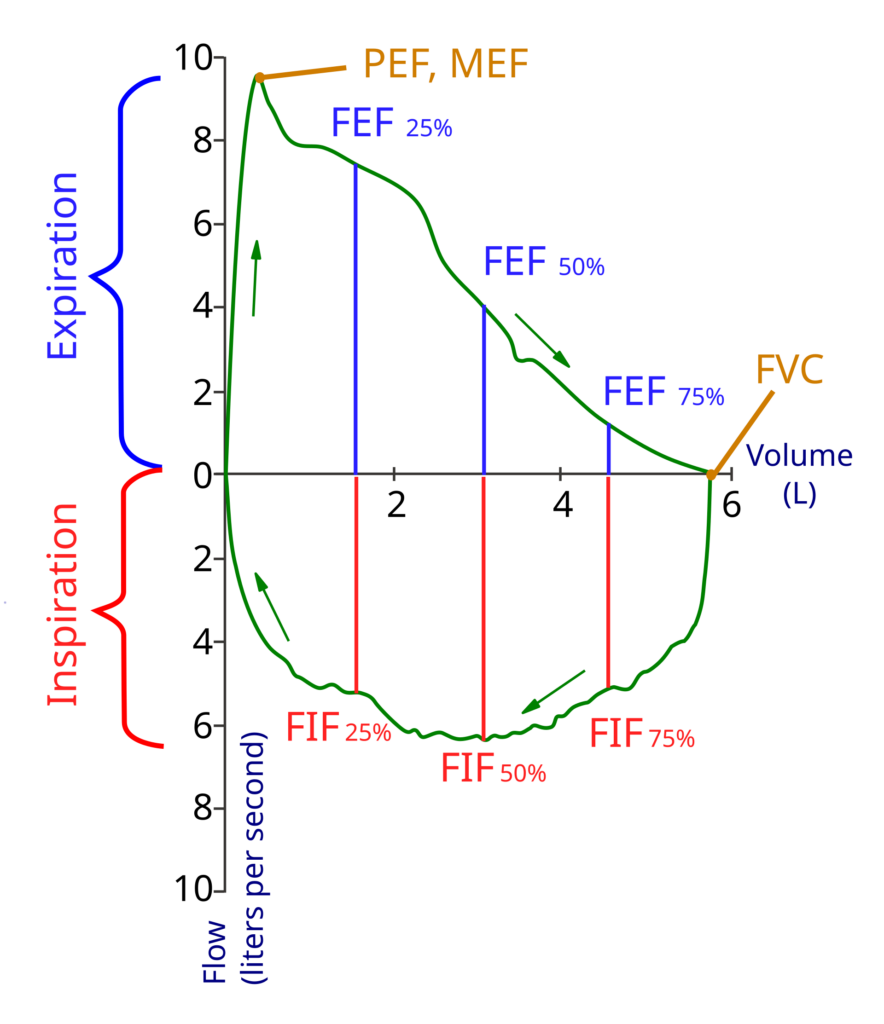 mymedschool.orgU01.16.033 Flow-Volume Loops in Lung Disease